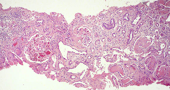 Amorphous_Deposits