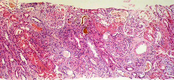 Pigmented casts